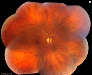 - Dr. Chirag M. Shah MD MPH